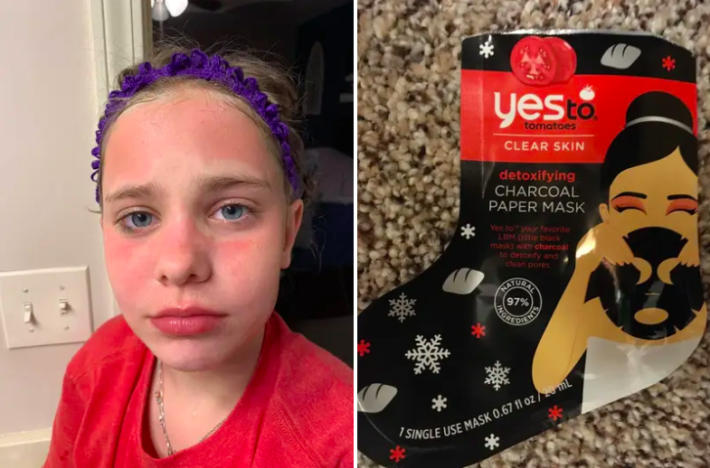 Some people are having terrible reactions to popular face mask – so it ...
