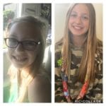 15 drastic transformations of people before and after braces