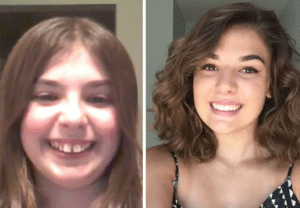 15 drastic transformations of people before and after braces