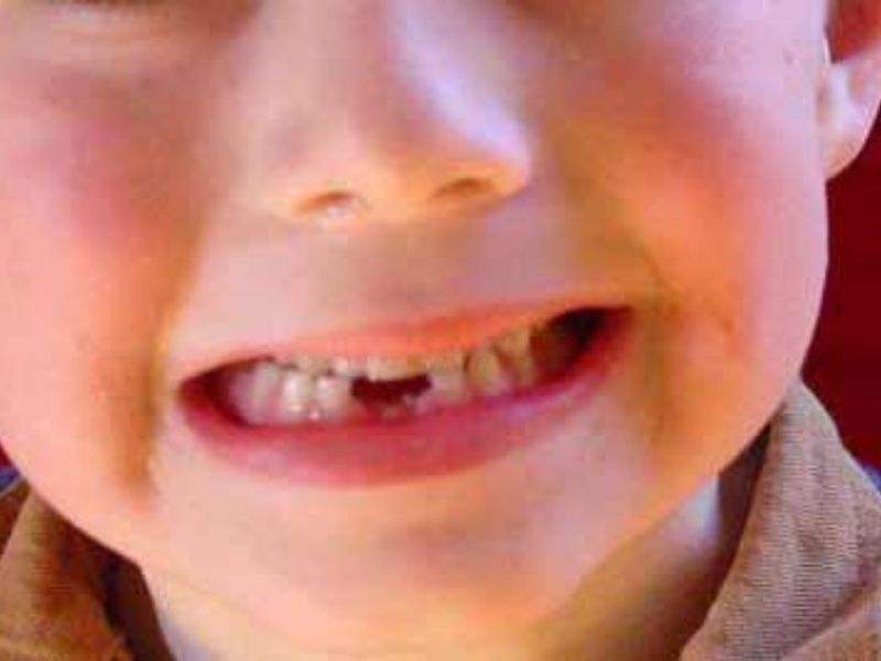 Researchers have discovered an antibody that can help regrow teeth