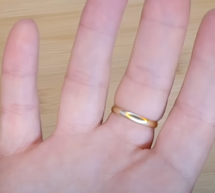 Woman shares simple trick the doctor showed her to remove stuck ring ...