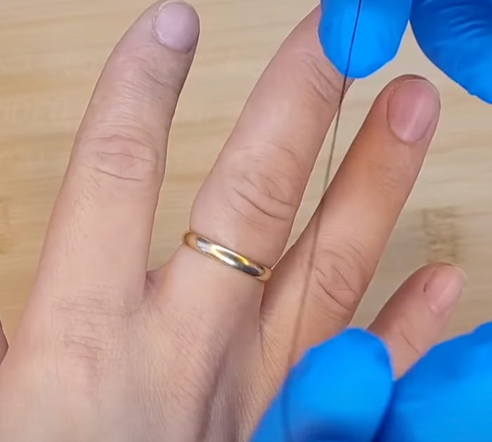 Woman shares simple trick the doctor showed her to remove stuck ring ...