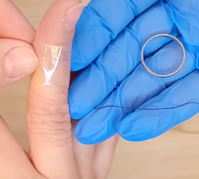 Woman Shares Simple Trick The Doctor Showed Her To Remove Stuck Ring