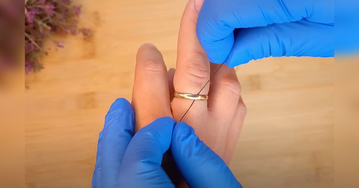 Woman Shares Simple Trick The Doctor Showed Her To Remove Stuck Ring