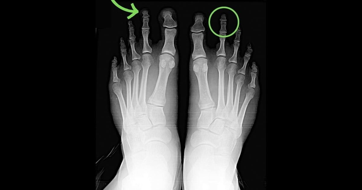 50 things your body’s telling you that you shouldn’t ignore